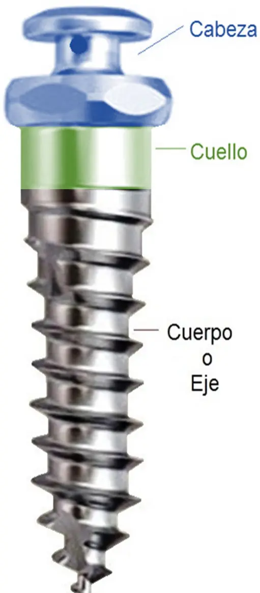Anclaje en Ortodoncia I - Micro-Implantes - Dra. Hernández Pando