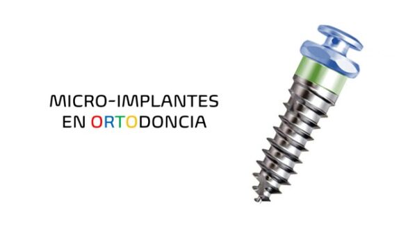 Anclaje en Ortodoncia I - Micro-Implantes - Dra. Hernández Pando